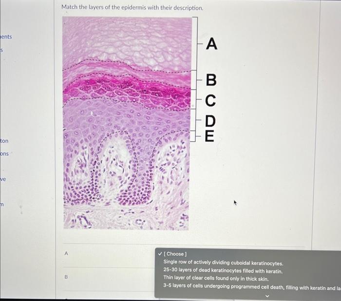 Solved Match the layers of the epidermis with their | Chegg.com
