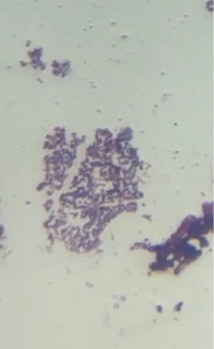 Solved list the possible bacterial microorganisms in the | Chegg.com