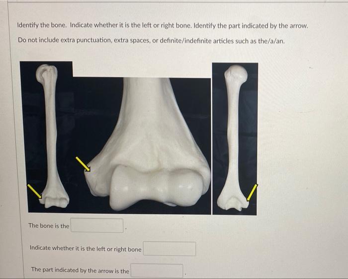Solved Identify the bone. Indicate whether it is the left or | Chegg.com