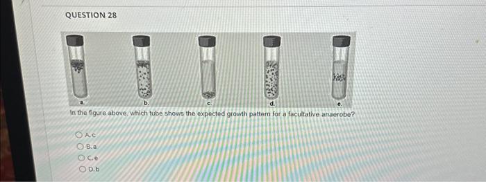 Solved QUESTION 28 In the figure above, which tube shows the | Chegg.com