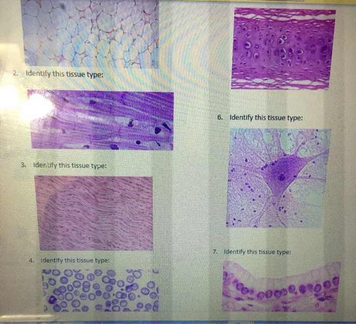 Solved 2. Identify this tissue type: 6. Identify this tissue | Chegg.com