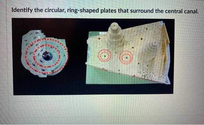 Solved Identify the circular, ring-shaped plates that | Chegg.com
