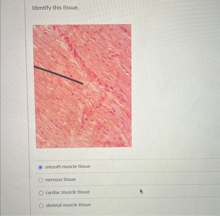 Solved Identify this tissue. smooth muscle tissue nervous | Chegg.com