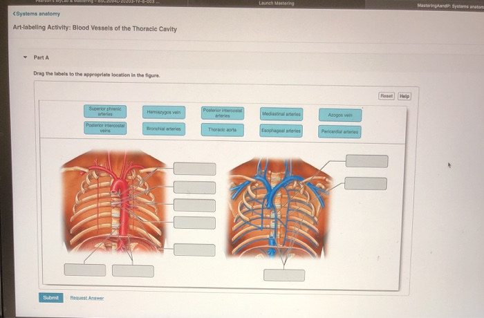 Solved Art-labeling Activity: Artories of the Head and Neck | Chegg.com