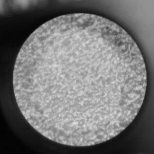 [Solved]: Metallographic analysis of steel/iron. Identify th