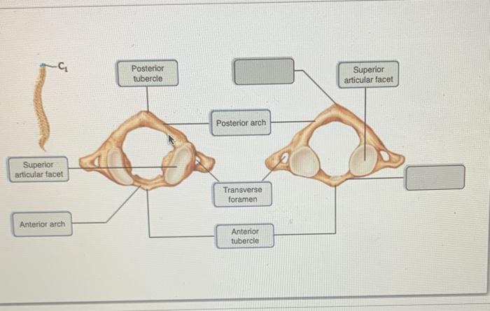 Solved C Posterior tubercle Superior articular facet | Chegg.com