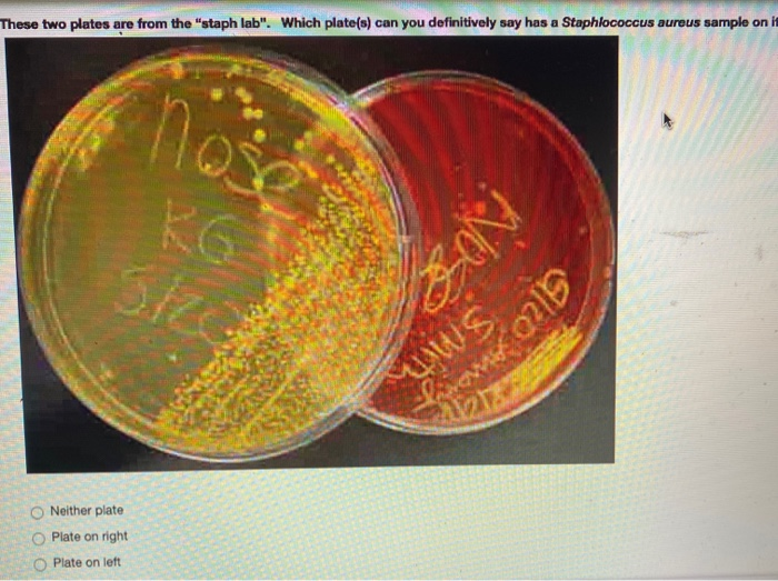 M-Staph broth: Is neither selective or differential | Chegg.com