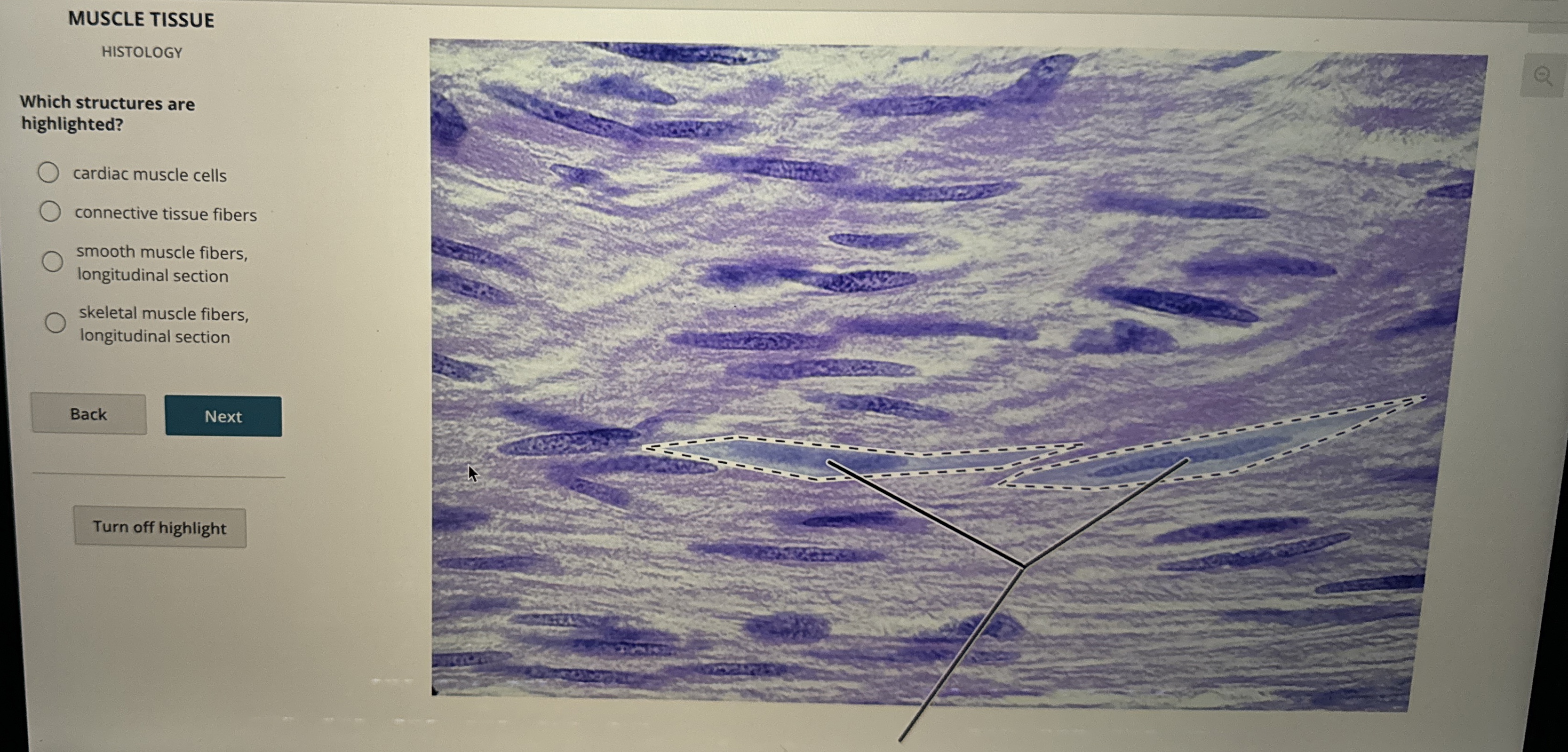 Solved MUSCLE TISSUEHISTOLOGYWhich structures | Chegg.com