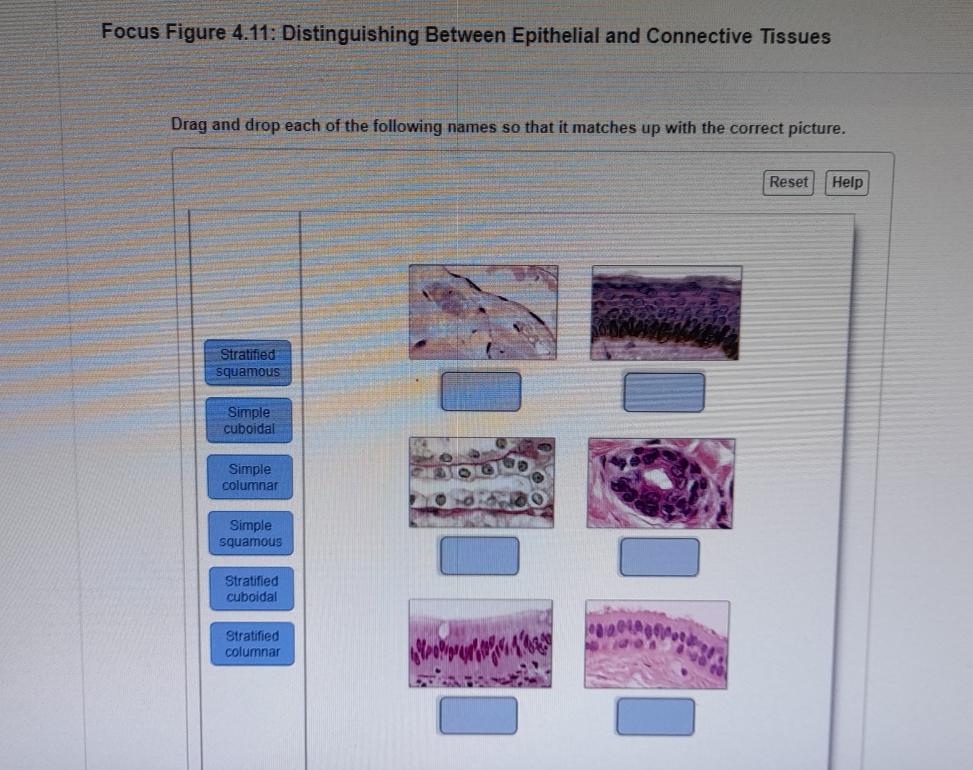 Solved Focus Figure 4.11: Distinguishing Between Epithelial | Chegg.com