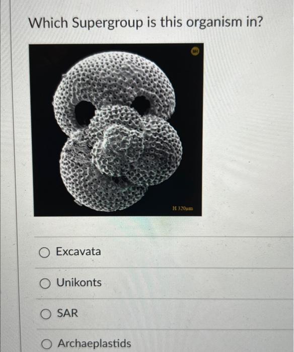 Solved What Supergroup is this organism in? O Excavata SAR | Chegg.com