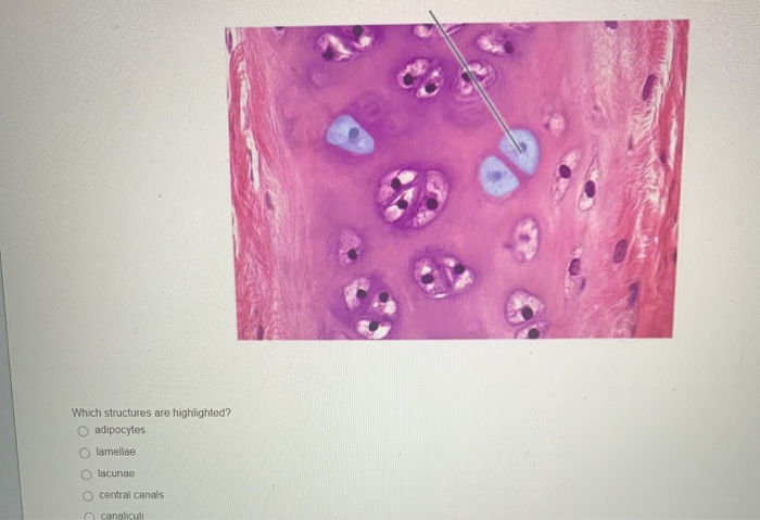 Solved Which structures are highlighted? o adipocytes | Chegg.com