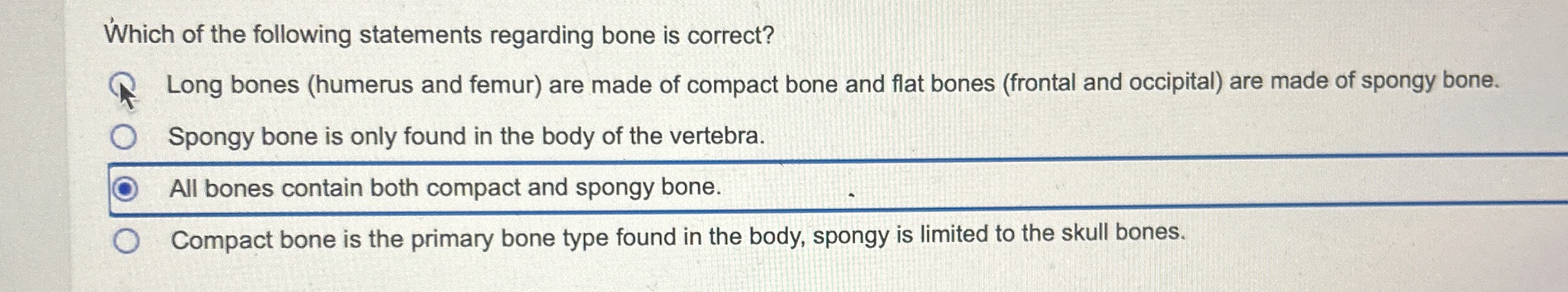 Solved Which of the following statements regarding bone is | Chegg.com