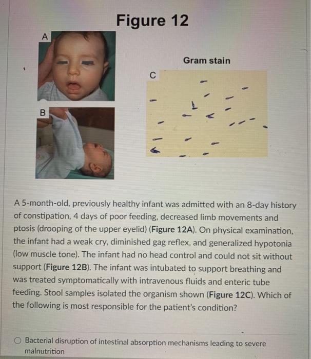 Solved Sabouraud agar Light India Ink staining of CSF sample | Chegg.com