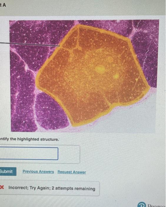 Solved НА entify the highlighted structure. Submit Previous | Chegg.com