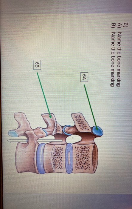 Solved 1) A) Name the bone B) Name the bone marking 6) A) | Chegg.com