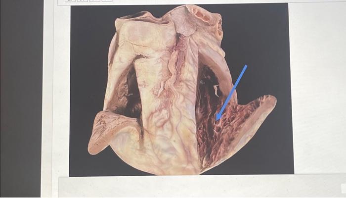 Solved identify the muscle at the end of the pointer | Chegg.com