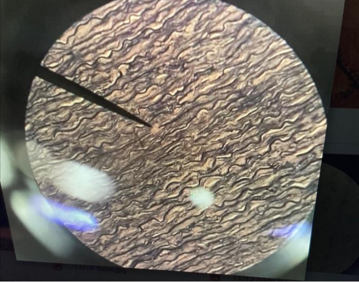 Solved Dense Elastic This type of connective tissue is found | Chegg.com