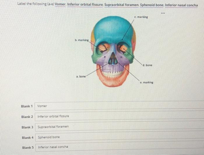 Solved Label the following (a-e) Vomer. Inferior orbital | Chegg.com
