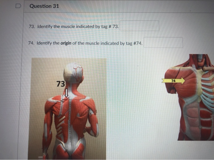 Solved Question 31 73. Identify the muscle indicated by tag | Chegg.com