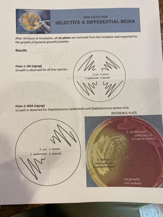 Solved DATA COLLECTION SELECTIVE & DIFFERENTIAL MEDIA After | Chegg.com