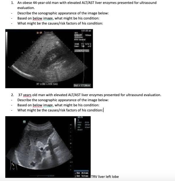 Solved 1. An obese 44-year-old man with elevated ALT/AST | Chegg.com
