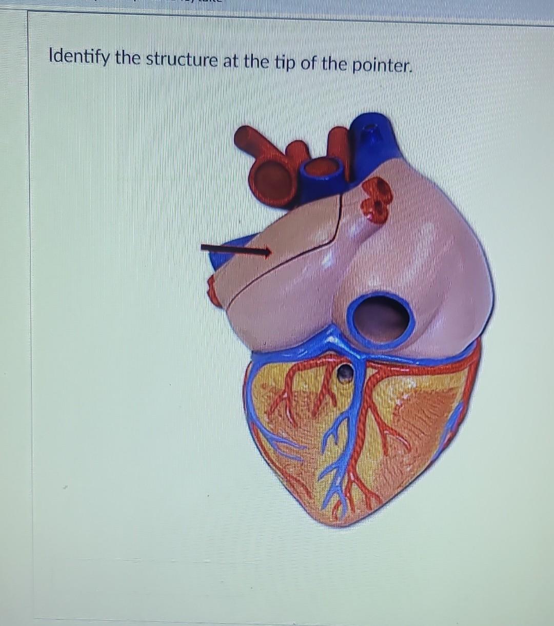 Solved Identify the structure at the tip of the | Chegg.com