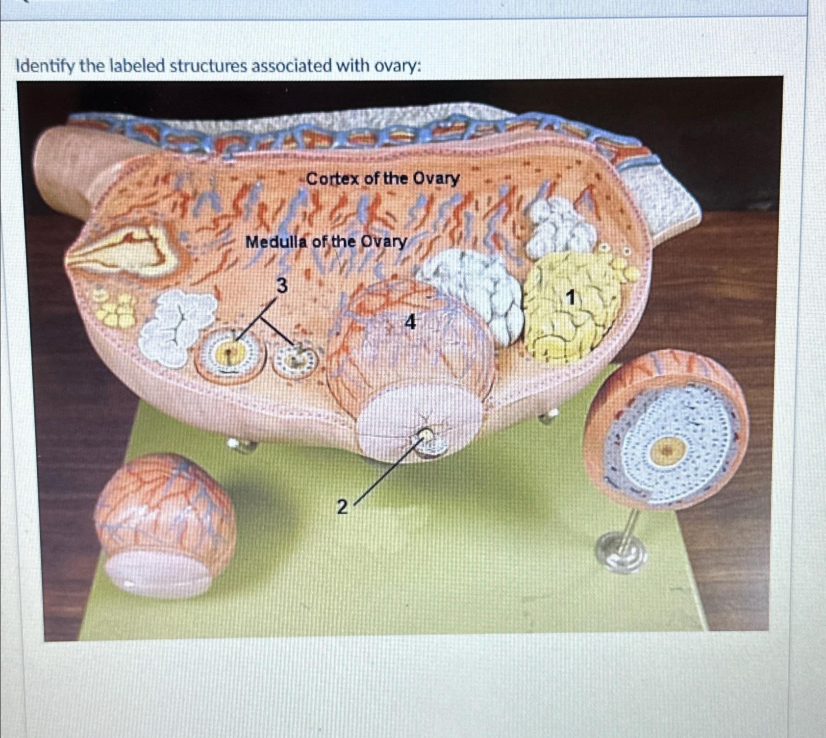 Solved Identify the labeled structures associated with | Chegg.com