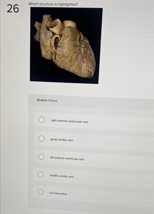 Solved Which structure is highlighted? Multiple Choice right | Chegg.com