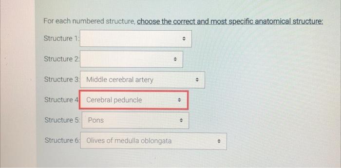 Solved Lateral view of brainstem For each numbered | Chegg.com