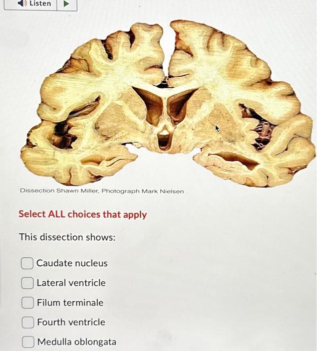 Solved Select ALL choices that apply This dissection shows: | Chegg.com Solved Select ALL choices that apply This dissection shows: | Chegg.com