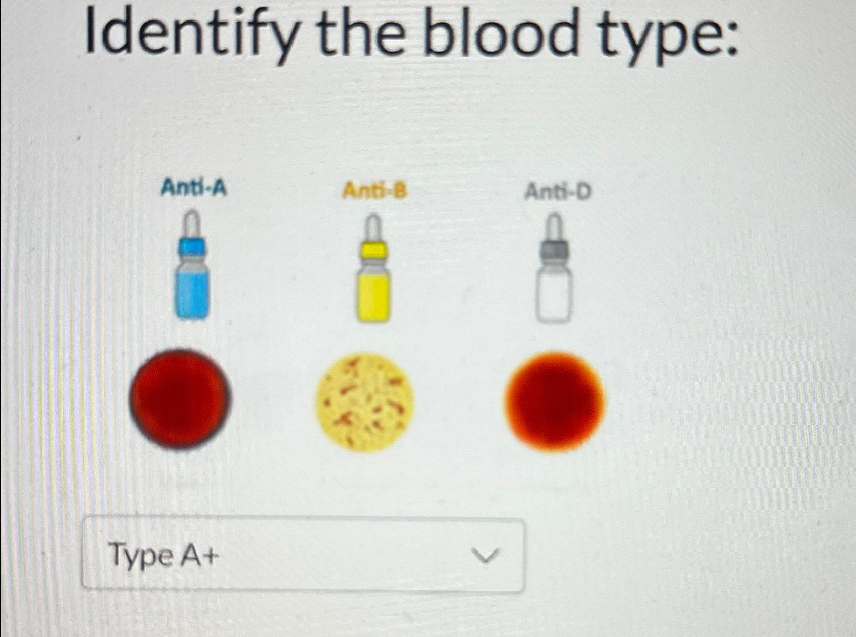 Solved Identify the blood type:Anti-AAnti-8Anti-0 | Chegg.com