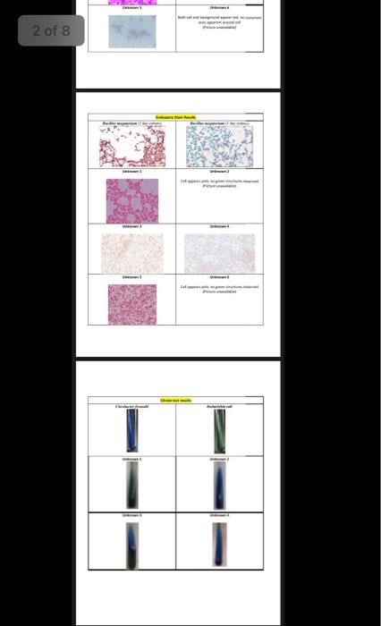 Complete the following table with your Capsule stain | Chegg.com