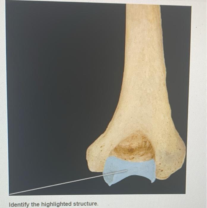 Solved Identify the highlighted structures. Name the type | Chegg.com