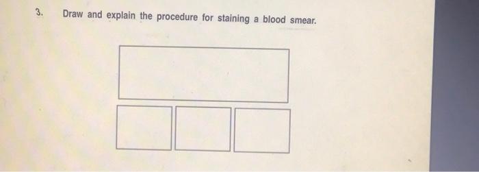 Solved 3. Draw and explain the procedure for staining a | Chegg.com