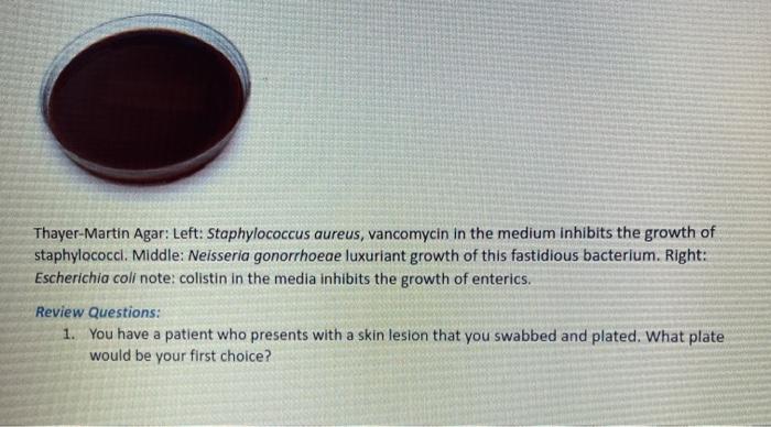 Solved Thayer-Martin Agar: Left: Staphylococcus aureus, | Chegg.com