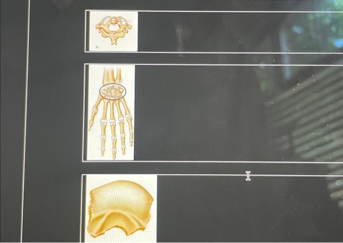 Solved what are these bones? | Chegg.com
