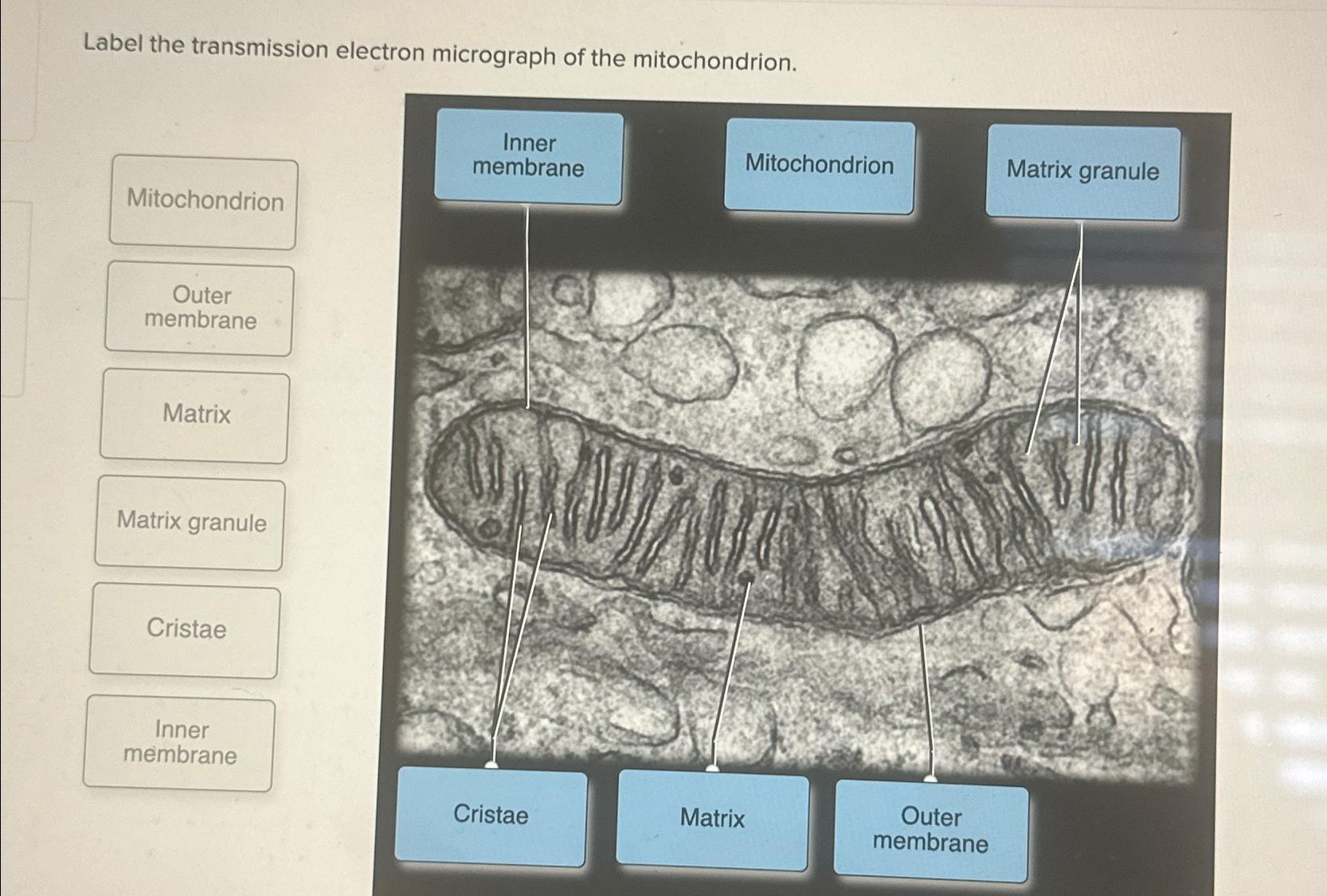 Solved Label the transmission electron micrograph of the | Chegg.com