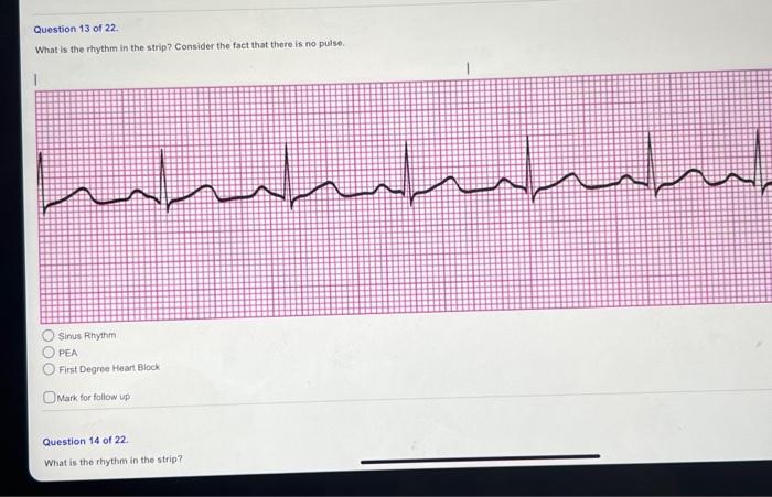 Question 13 of 22 . What is the rhythm in the strip? | Chegg.com