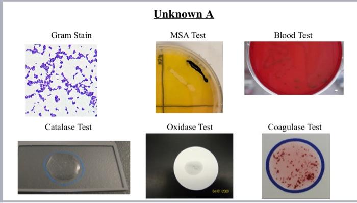 Staphylococcus Aureus Catalase Test