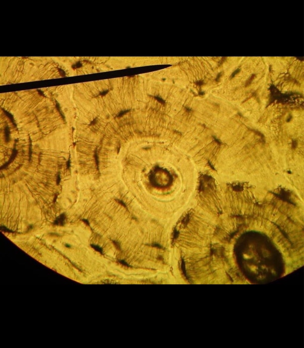 Solved Bone Examine the Haversian systems with the high | Chegg.com