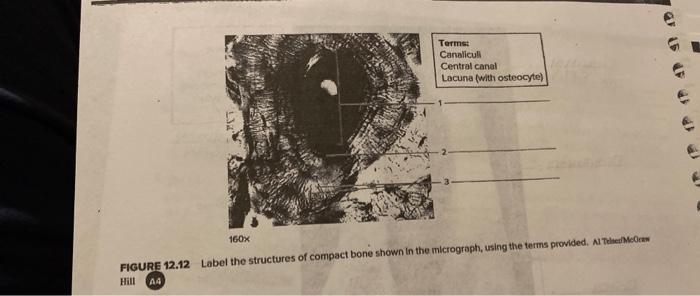 Solved FIGURE 12.12 Label the structures of compact bone | Chegg.com