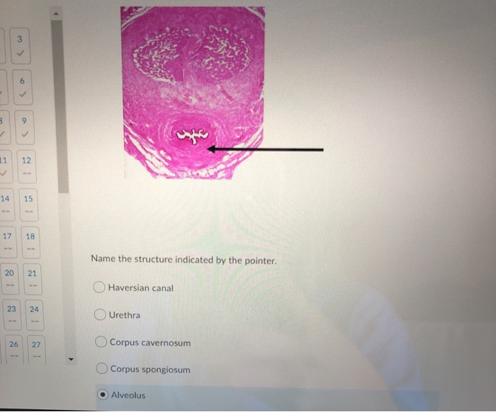 Solved Name the structure indicated by the pointer. | Chegg.com