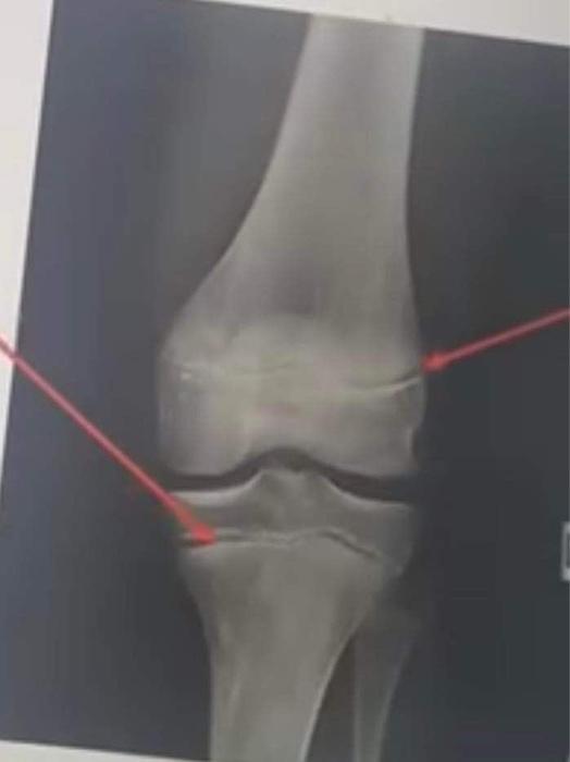 Solved What is the part of the bone indicated by the yellow | Chegg.com