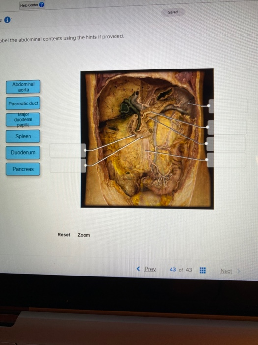 Solved Help Center Saved abel the abdominal contents using | Chegg.com