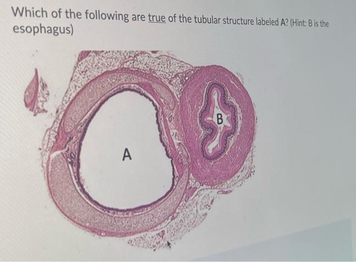 Solved Which of the following are true of the tubular | Chegg.com