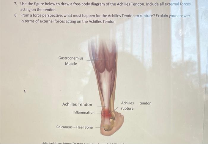 Solved 7. Use the figure below to draw a free-body diagram | Chegg.com