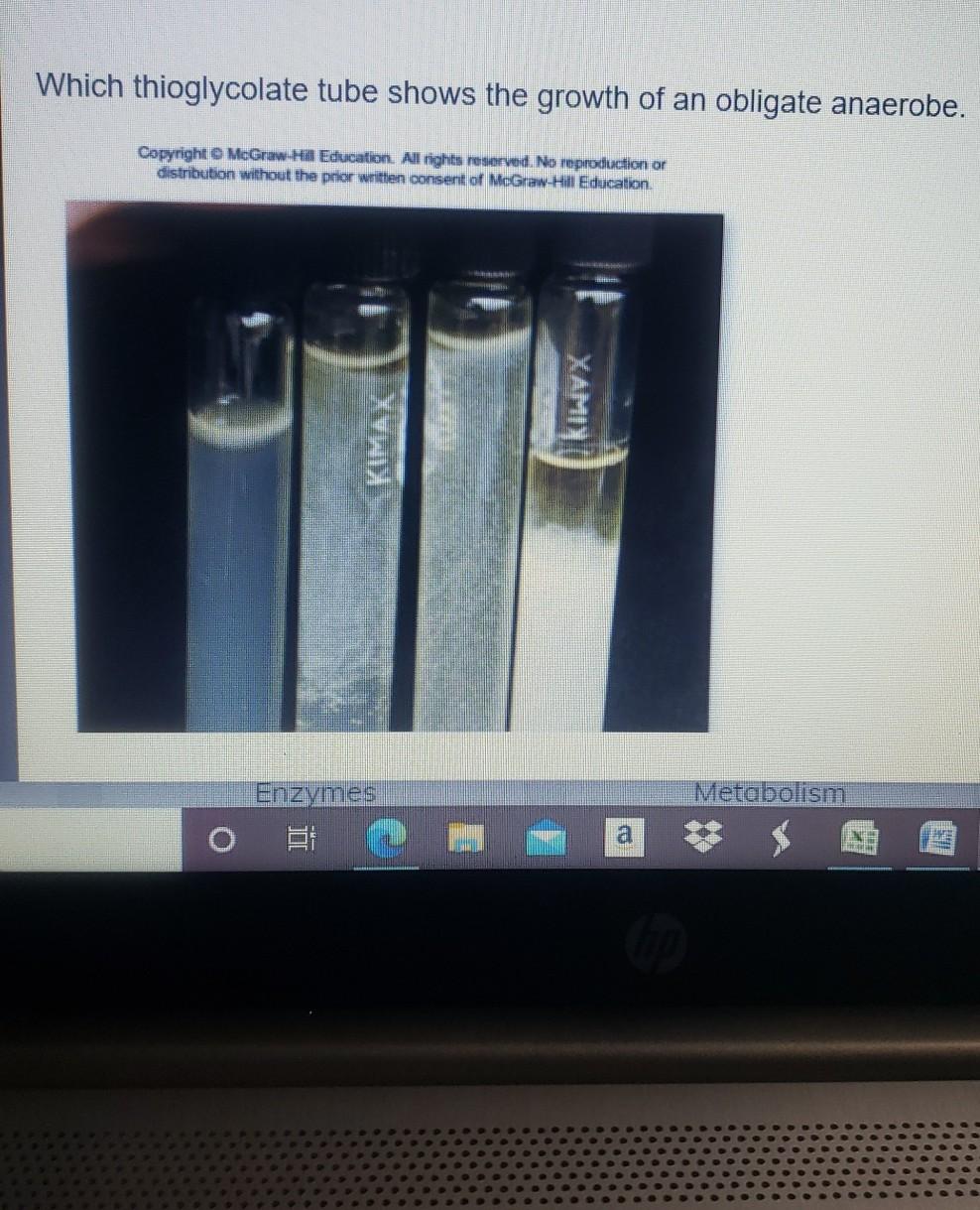 Which thioglycolate tube shows the growth of an | Chegg.com