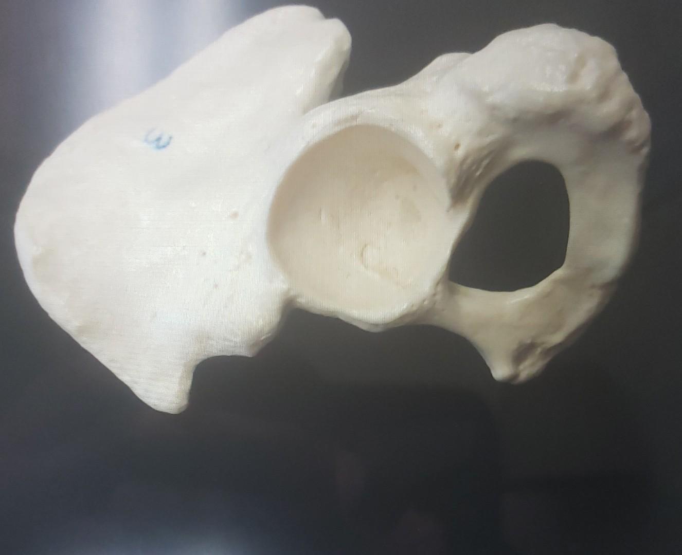 Solved pls labels this hip bone | Chegg.com Solved pls labels this hip bone | Chegg.com