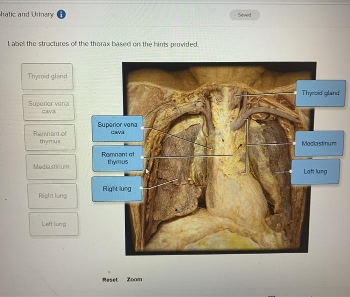 Solved Saved the thorax based on the hints provided. Thyroid | Chegg.com