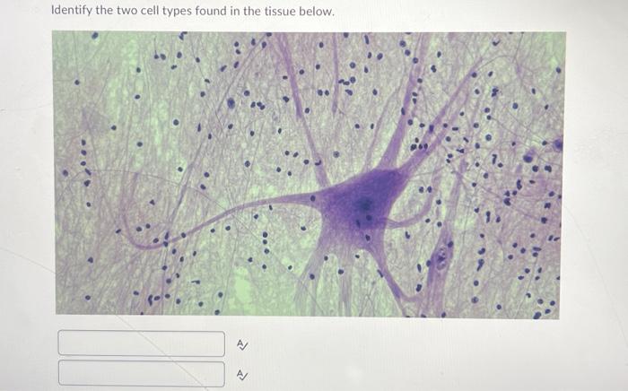 Solved Identify the two cell types found in the tissue | Chegg.com